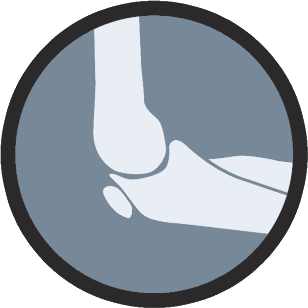 Elbow Studies - Royal Baby Cartoon Clipart - Full Size Clipart ...