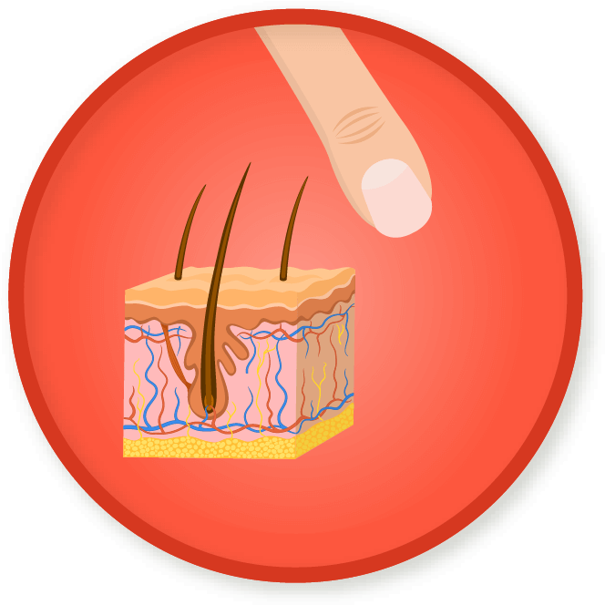 Download Picture Free Skin Clipart Integumentary System - Integumentary ...