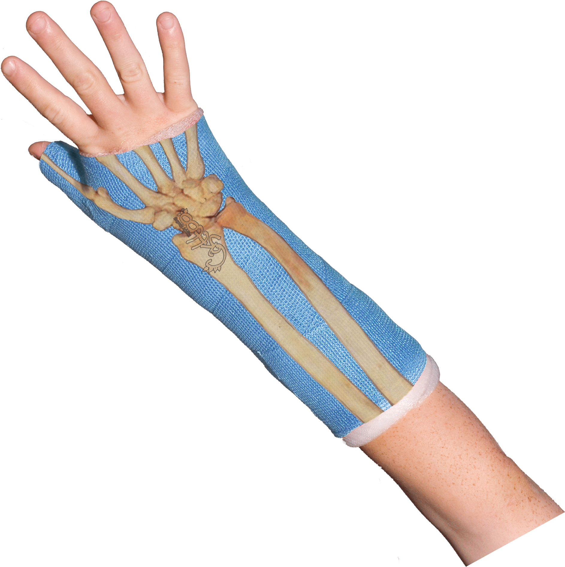 Download Bones Wrist Bones Casttoo Orthopedic Cast Tattoos Gif Clipart ...