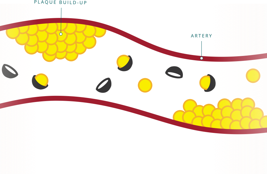 Download Bad Cholesterol Clipart (#3063837) - PinClipart