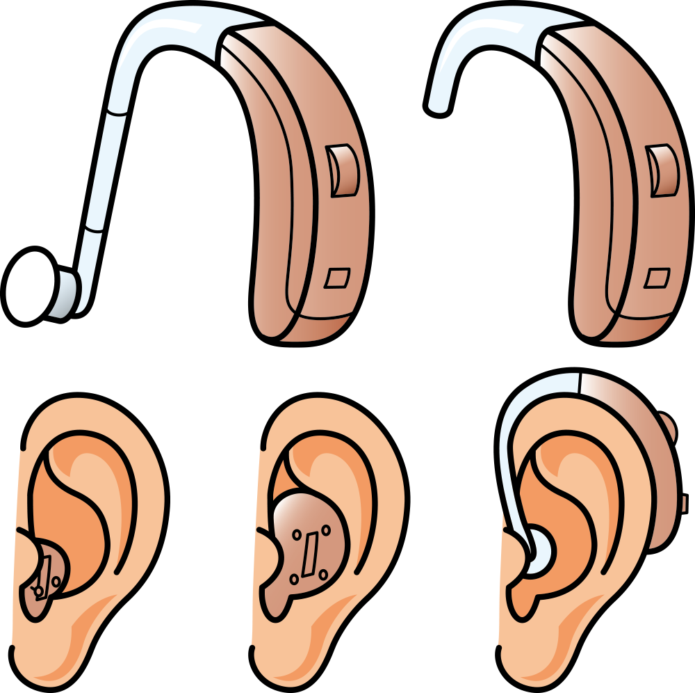 Hearing Aid Hearing Loss Clipart - Full Size Clipart (#3074868 ...