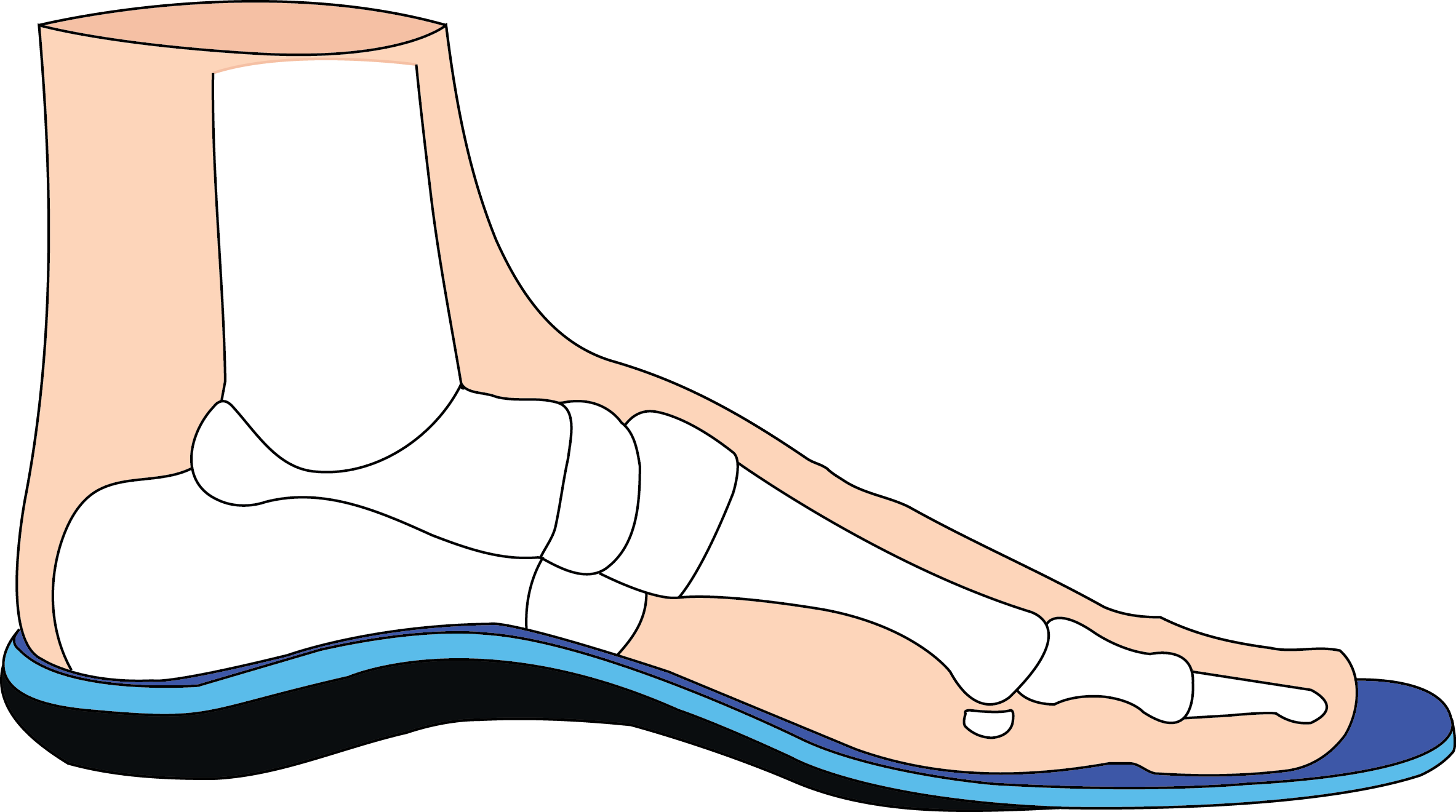 Resonance Dynamic Foot Orthotics Clipart - Full Size Clipart (#3674424 ...