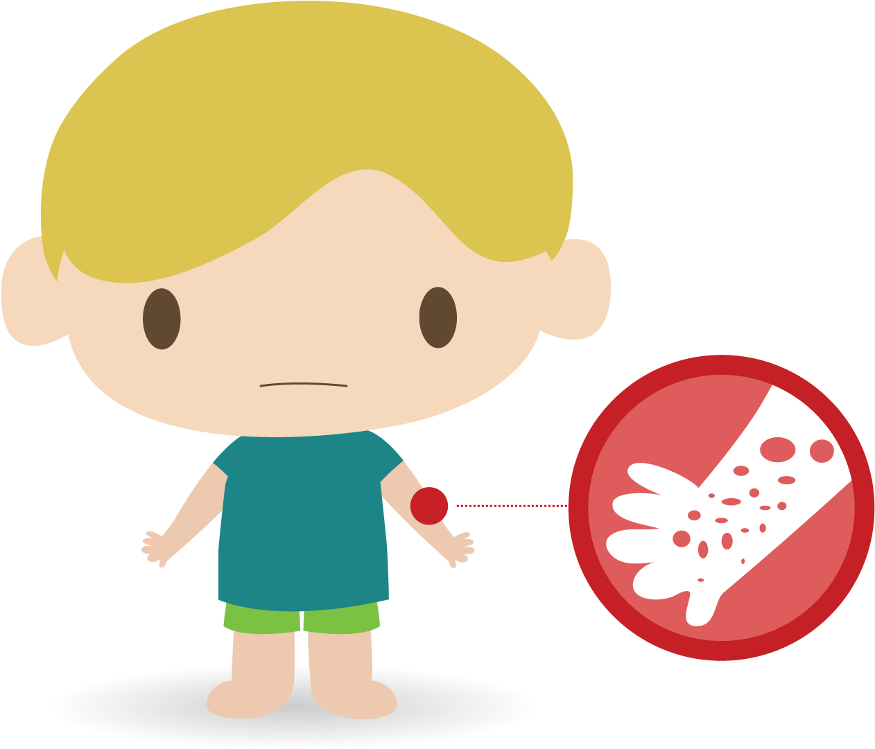 Download Patient Clipart Boy Sick - Rashes Png Transparent Png (#372220 ...