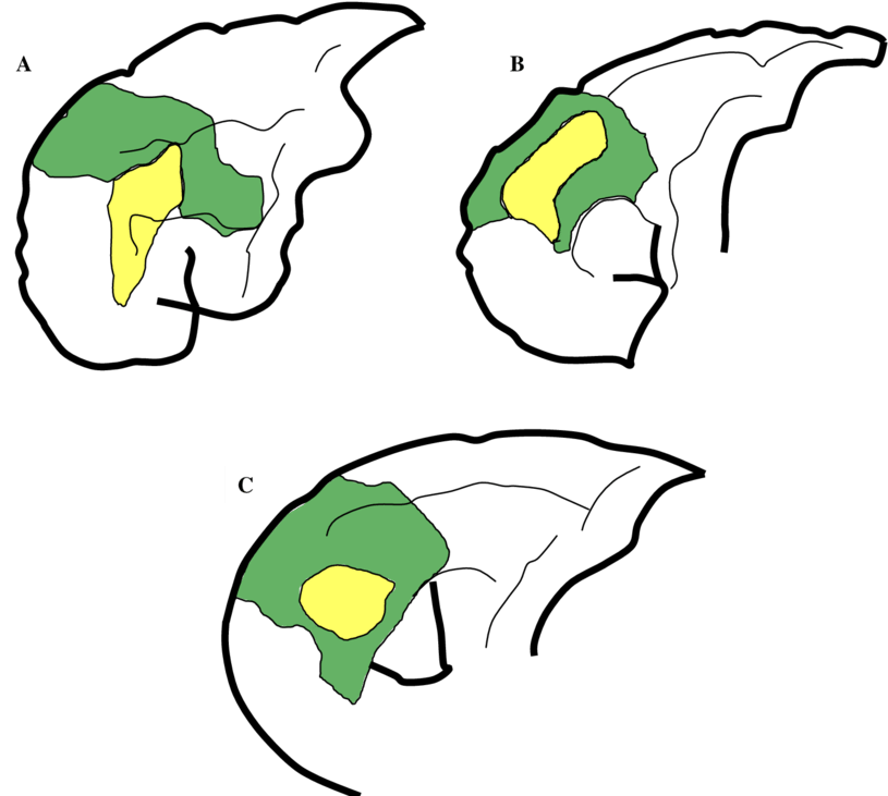 Comparison Of Approximate Locations Of Areas 9 And Clipart - Full Size ...