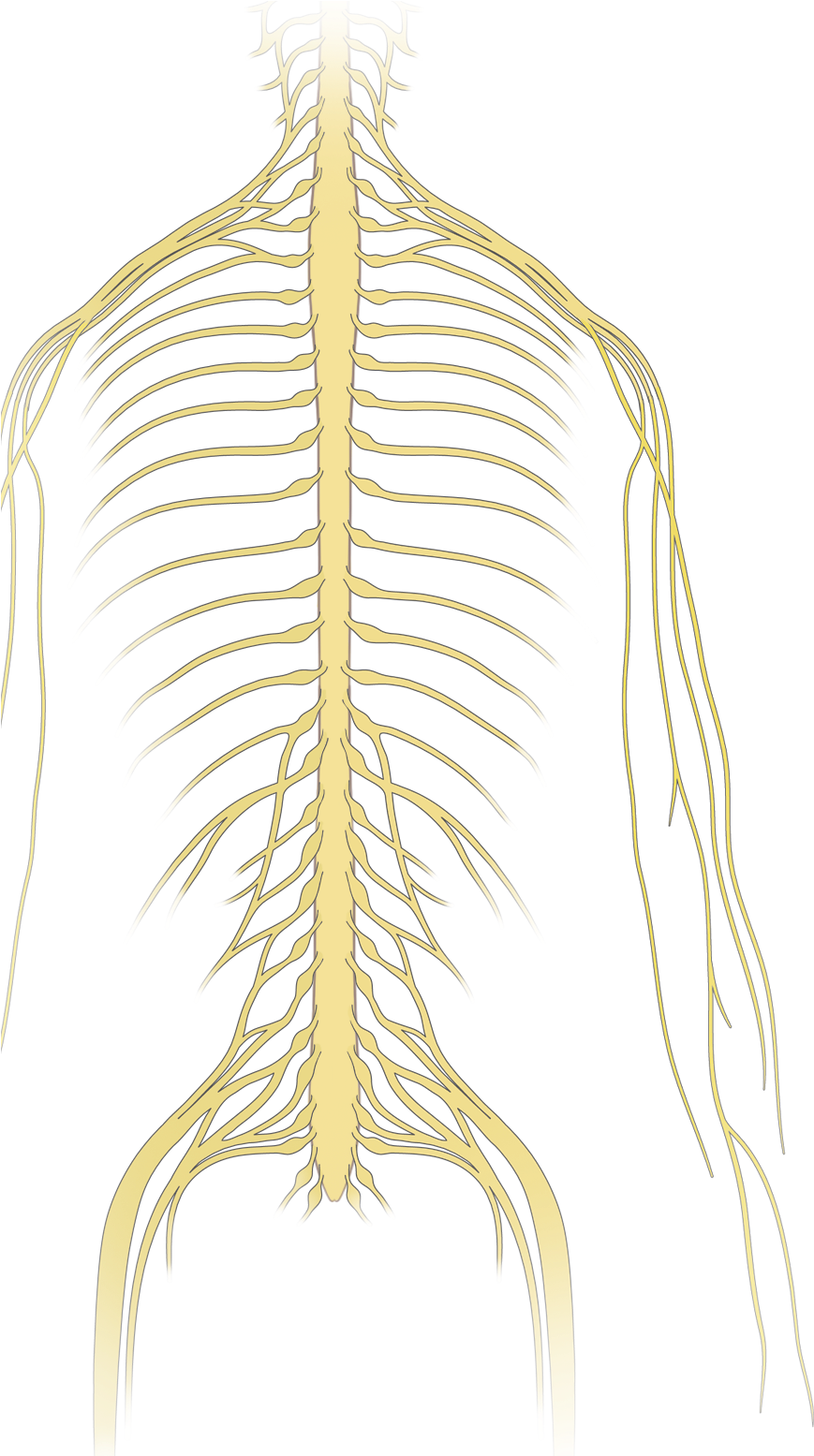 Neoplastic Epidural Spinal Cord Compression Nejm - Spinal Cord ...