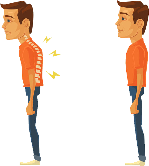 Download How To Fix Hunchback Posture Or Kyphosis - Fix Hunchback ...