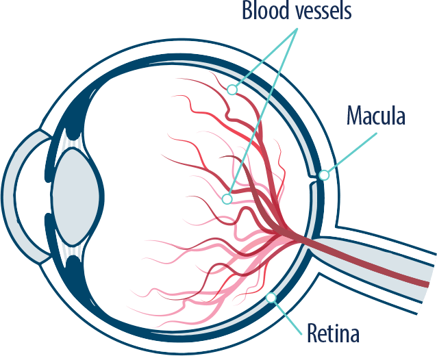 Eye Blood Vessels, Macula, And Retina - Macular Degeneration Eye Png ...