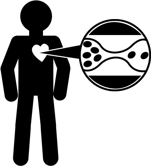 Heart Blockage - Cardiovascular Icono Clipart - Full Size Clipart ...