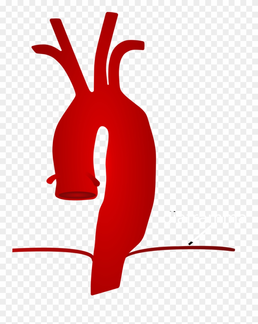 Download Chest Pain History - Aorta Clipart (#207418) - PinClipart
