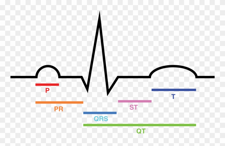 Download File - Ecg Intervals - Svg Clipart (#2995590) - PinClipart
