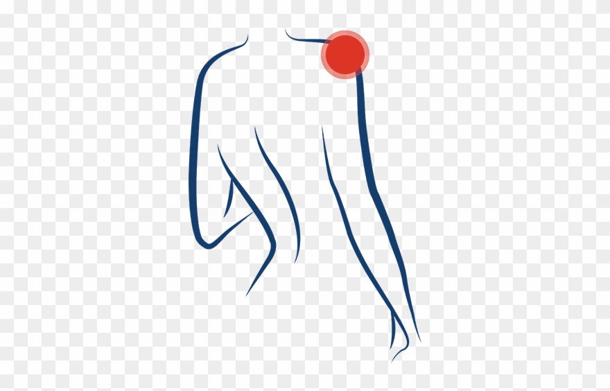 Download Rotator Cuff Injury Clipart (#3692093) - PinClipart