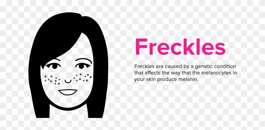 Download Freckles Png - Freckles Cartoon Clipart (#3929044) - PinClipart