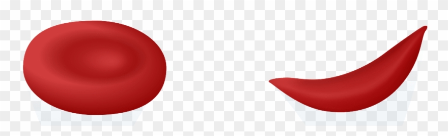 Download Transparent Sickle Cell Graphic Clipart (#524541) - PinClipart