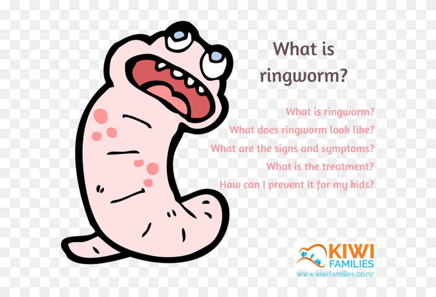 Worms Clipart Ringworm - Ringworm Nz - Png Download (#5276608) - PinClipart