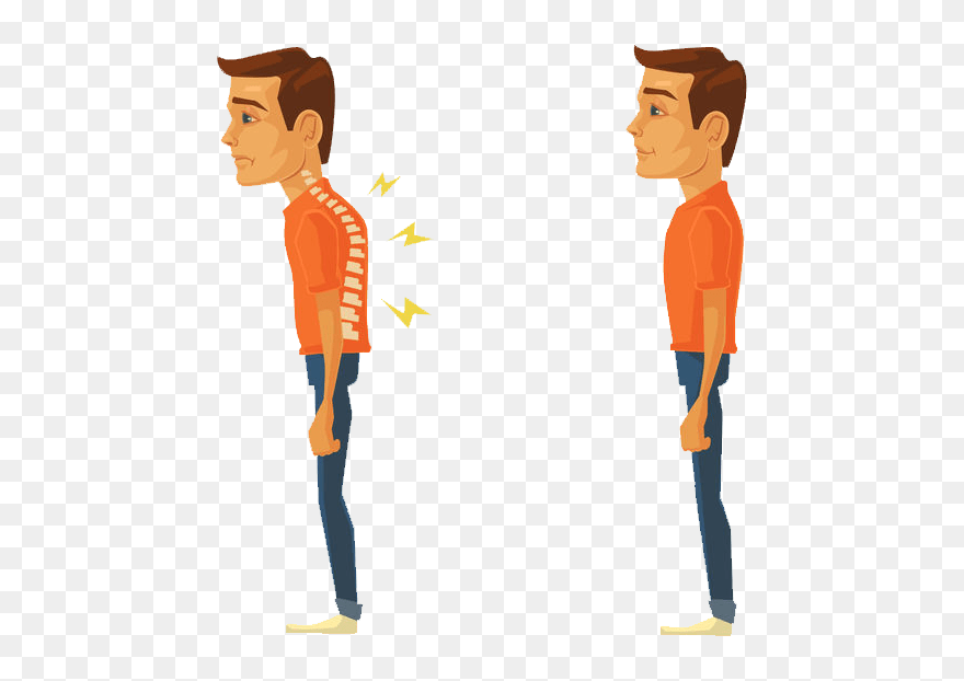 How To Fix Hunchback Posture Or Kyphosis - Fix Hunchback Posture ...