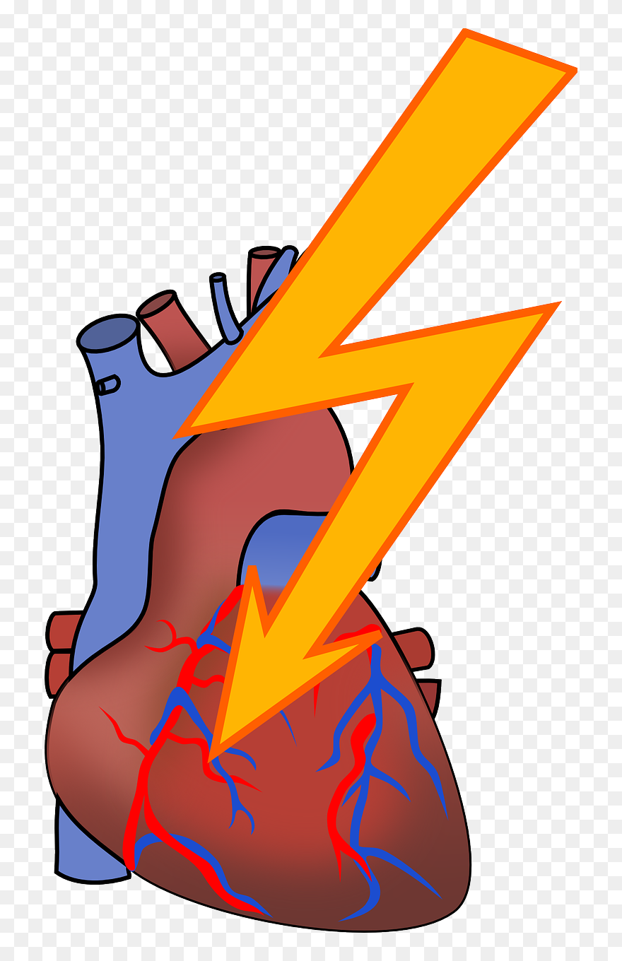 Cartoon Heart Attack Symptoms