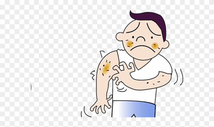 Allergy Clipart Anaphylactic Shock - Allergy Clip Art - Png Download ...